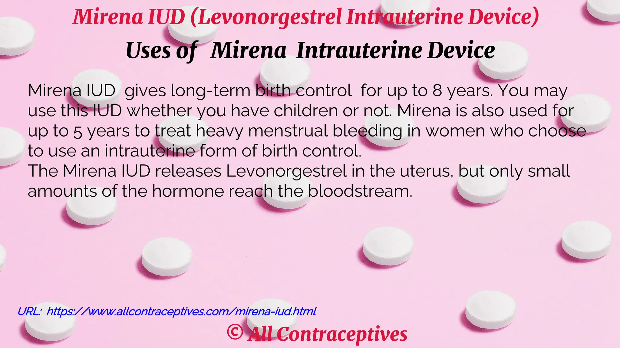 Mirena IUD (Levonorgestrel Intrauterine Device) | PDF