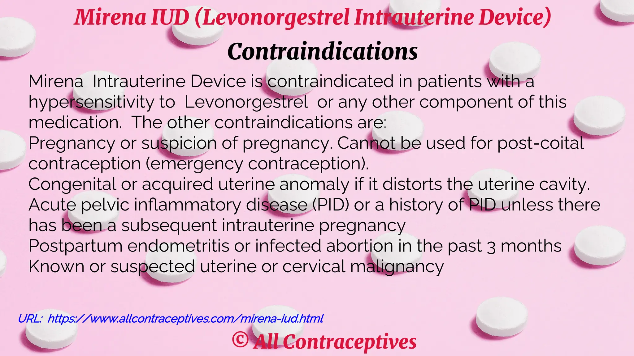 Mirena IUD (Levonorgestrel Intrauterine Device) | PDF