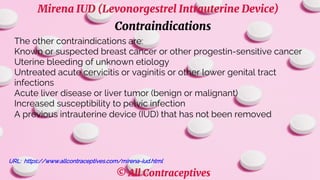 Mirena IUD (Levonorgestrel Intrauterine Device) | PDF