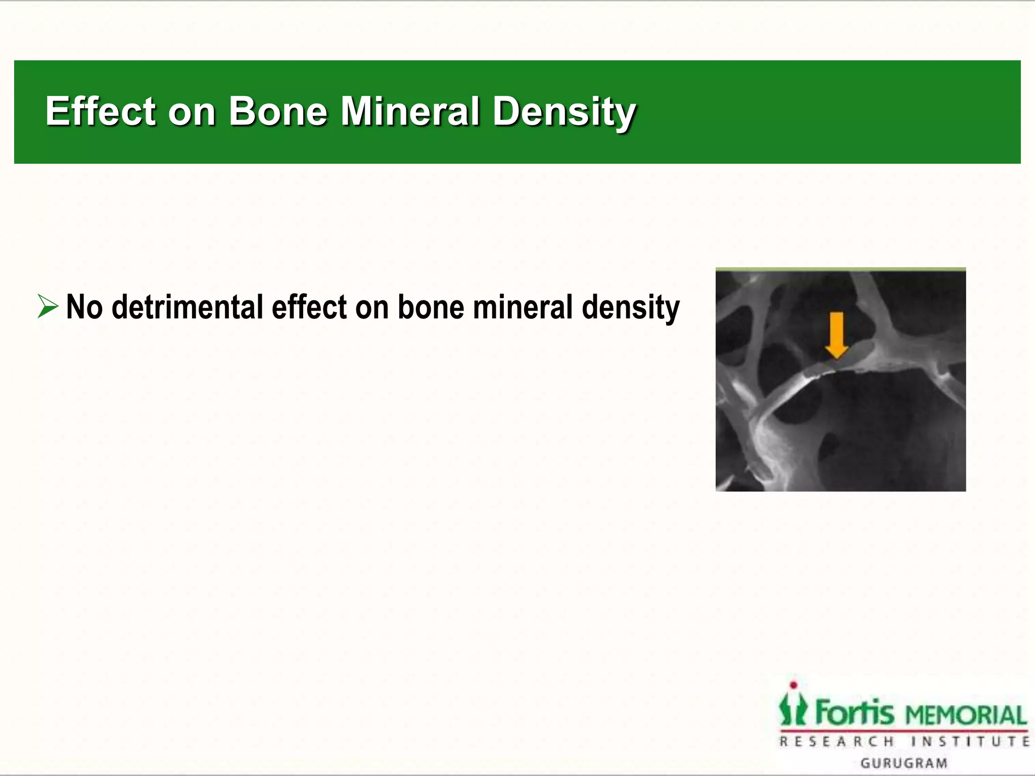 Mirena: An emerging tool in managing abnormal uterine bleeding | PPTX ...