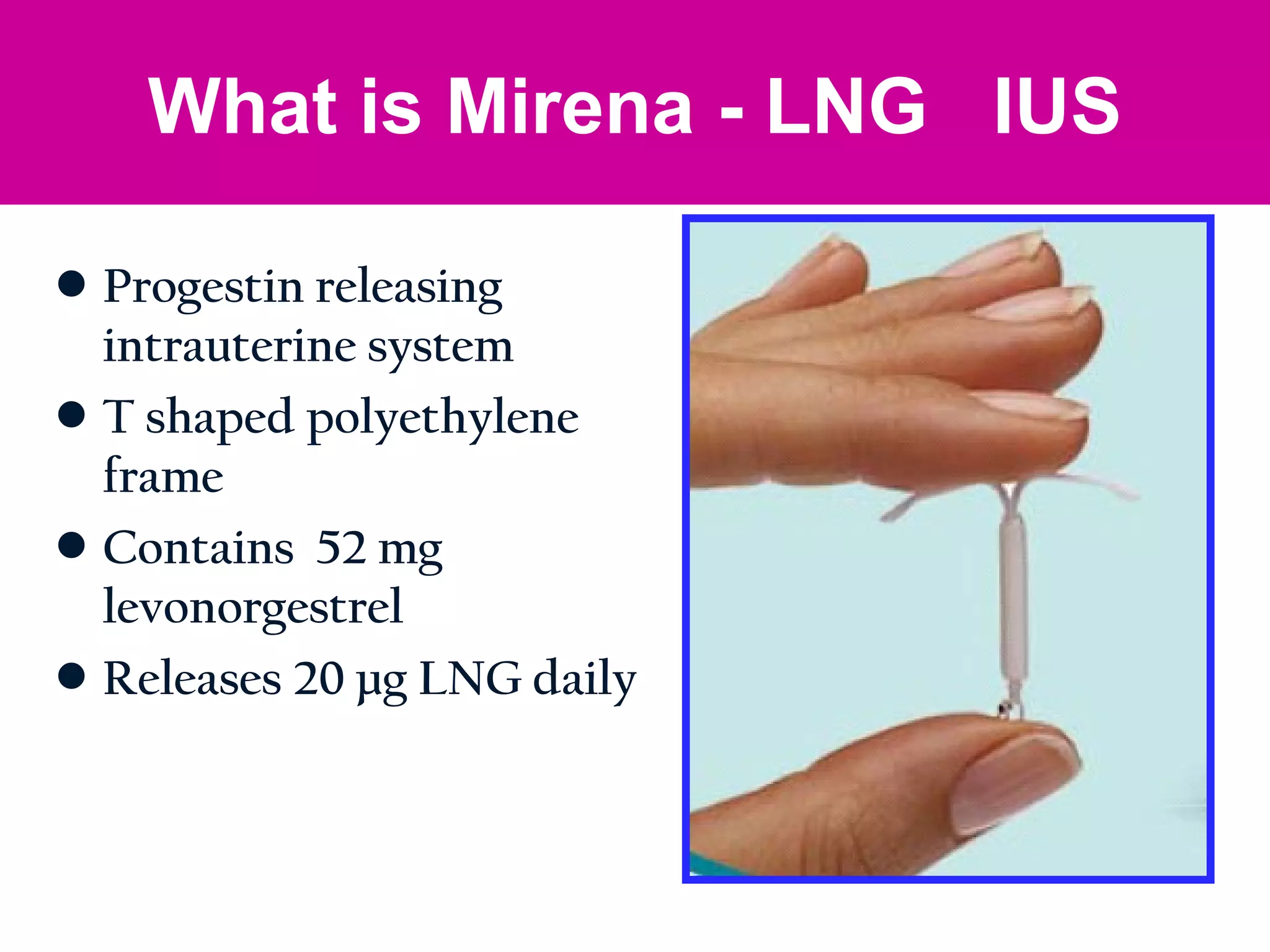 LNG-IUS: heavy menstrual bleeding What is new??? Dr. Jyoti Agarwal / Dr ...