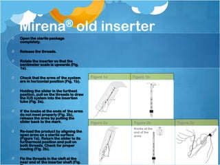 Mirena evo insertion | PPTX