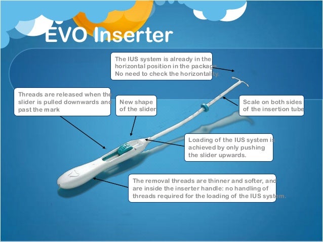 Placement Of Mirena Inserter Mirena Evoinserter Mirena® IUD Insertion