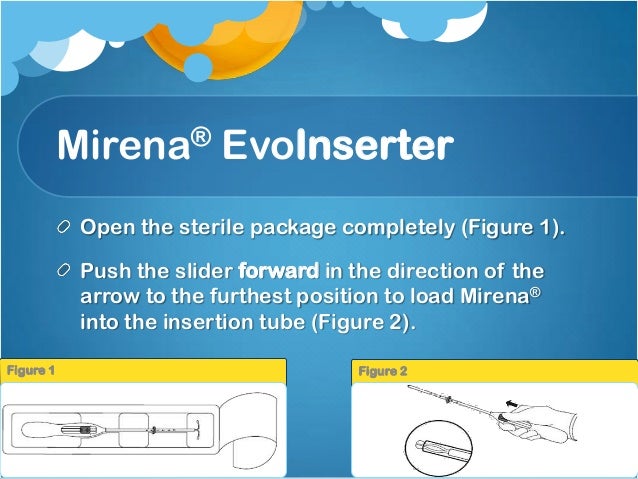 Placement Of Mirena Inserter Mirena Evoinserter