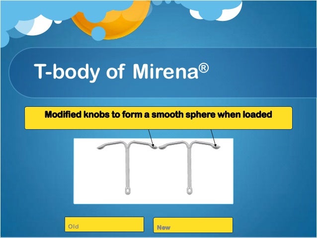 Placement Of Mirena Inserter Mirena Evoinserter