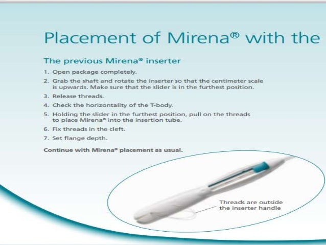 Placement Of Mirena Inserter Mirena Evoinserter Mirena® IUD Insertion
