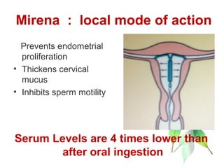 Mirena its role in menorrhagia dr. jyoti bhaskar,lecture -3 | PPT