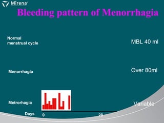 Mirena lng iucd case discussions | PPT