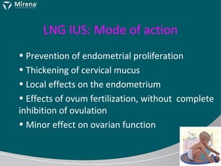 Mirena lng iucd case discussions | PPT