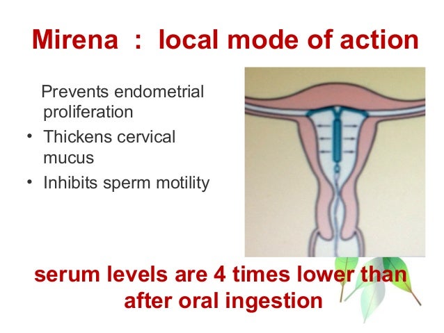 Irregular Bleeding With Mirena