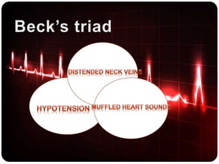 cardiac tamponade | PPTX