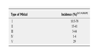Mirizzi syndrome ppt | PPTX