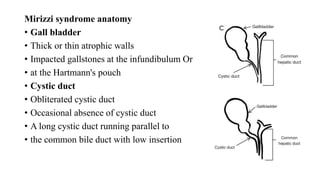 Mirizzi syndrome ppt | PPTX | Digestive Disorders | Diseases and Conditions