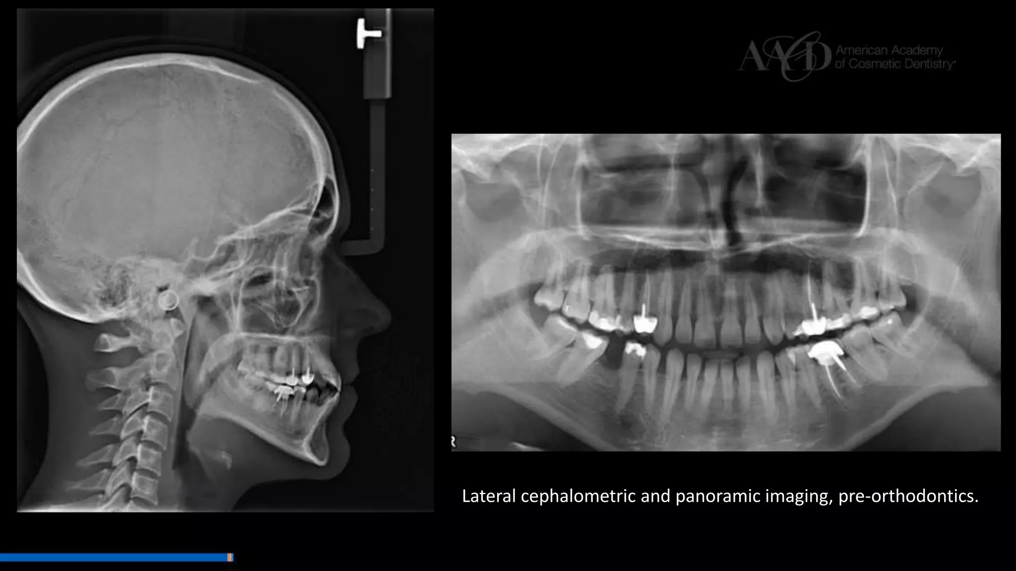 Esthetic Smile Design | PDF