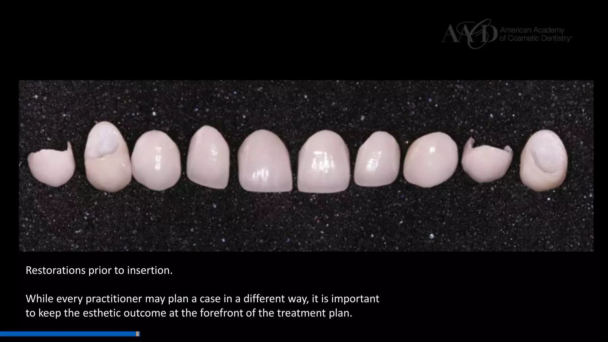 Esthetic Smile Design | PDF