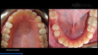 Esthetic Smile Design | PDF