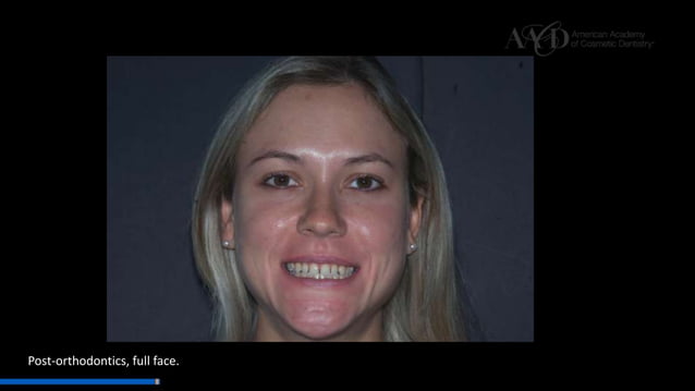 Esthetic Smile Design | PDF | Dental Health | Diseases and Conditions