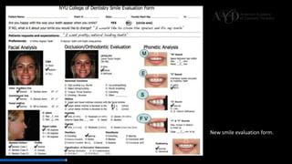 Esthetic Smile Design | PDF