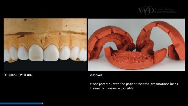 Esthetic Smile Design | PDF | Dental Health | Diseases and Conditions