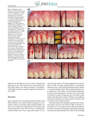 Miron et al. 2017 PRF Systematic Review.pdf