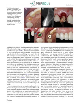 Miron et al. 2017 PRF Systematic Review.pdf