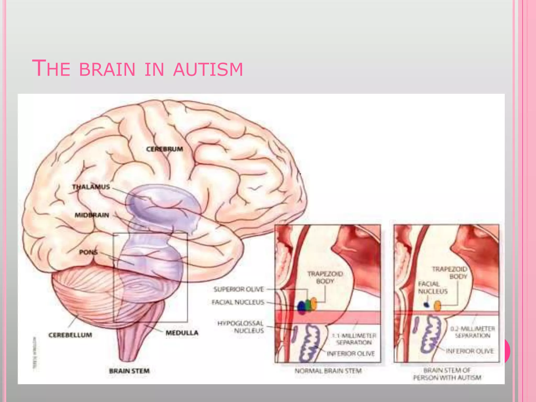 Mirror neurons and autism | PPTX