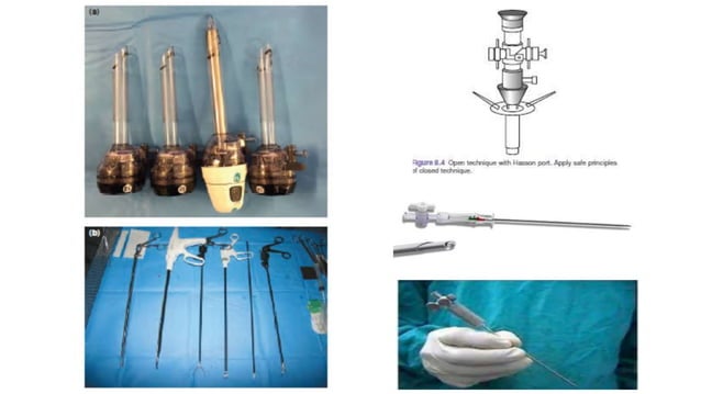 Minimal access surgery basics.pptx | Death, Injury, or Military ...