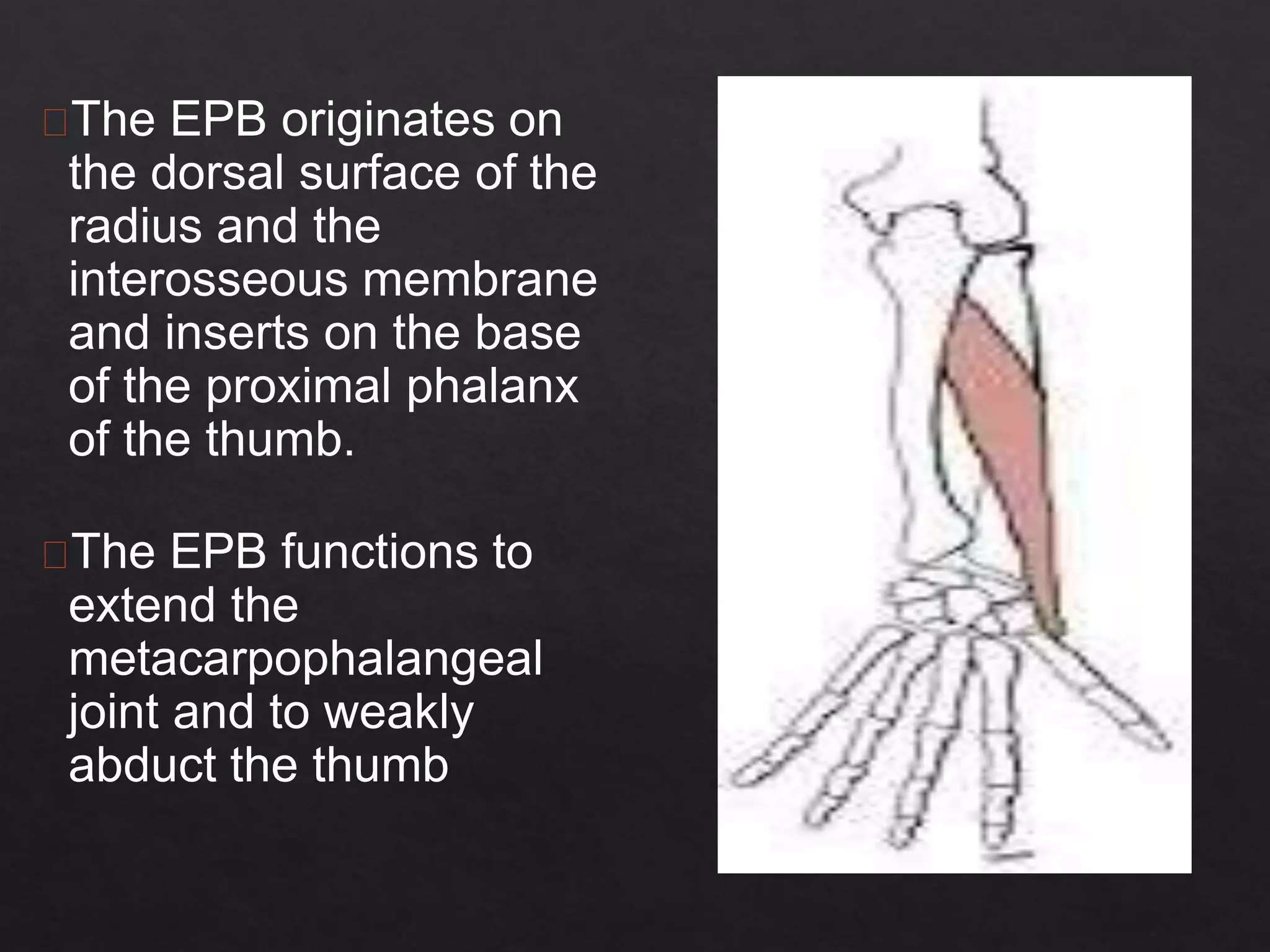 Misc. affections of soft tissue | PPTX