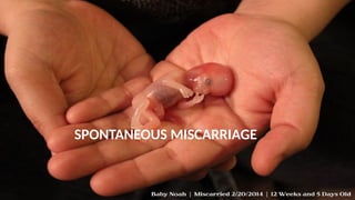 MISCARRIAGE IN PREGNANCY AND HOW IT IS FUNCTION | PPTX