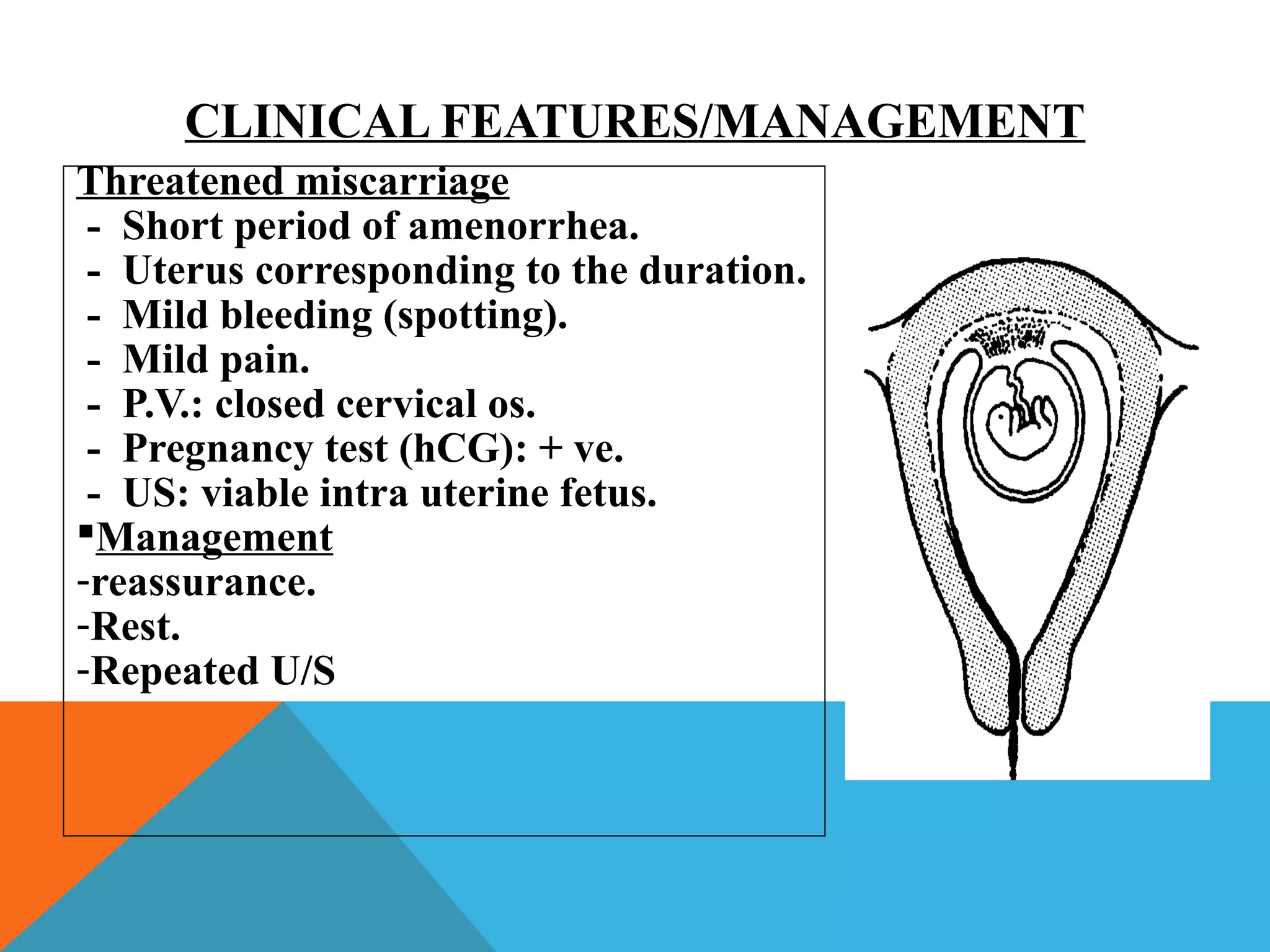 Miscarriages | PPT