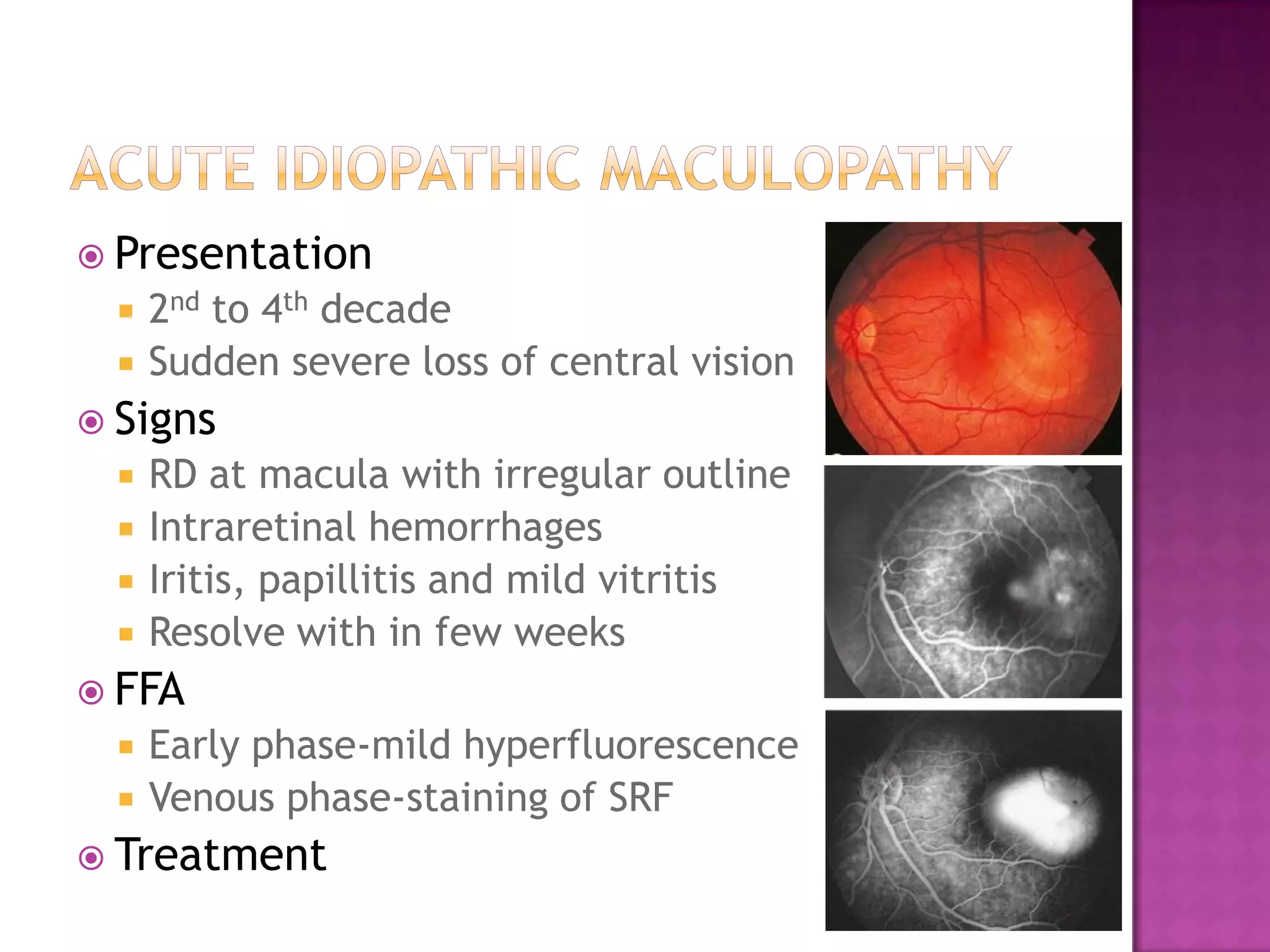 Miscellaneous Anterior And Posterior Uveitis Ppt