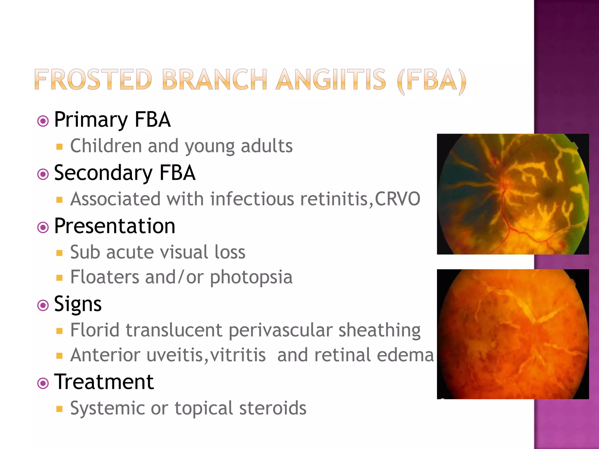 Miscellaneous anterior and posterior uveitis | PPTX