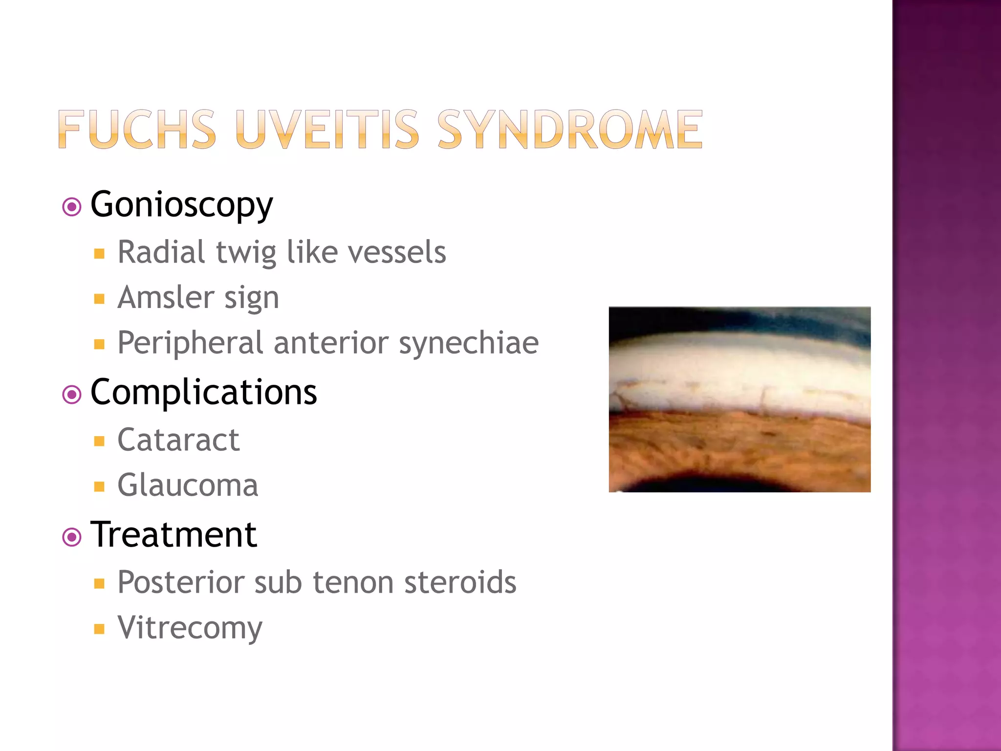 Miscellaneous anterior and posterior uveitis | PPTX