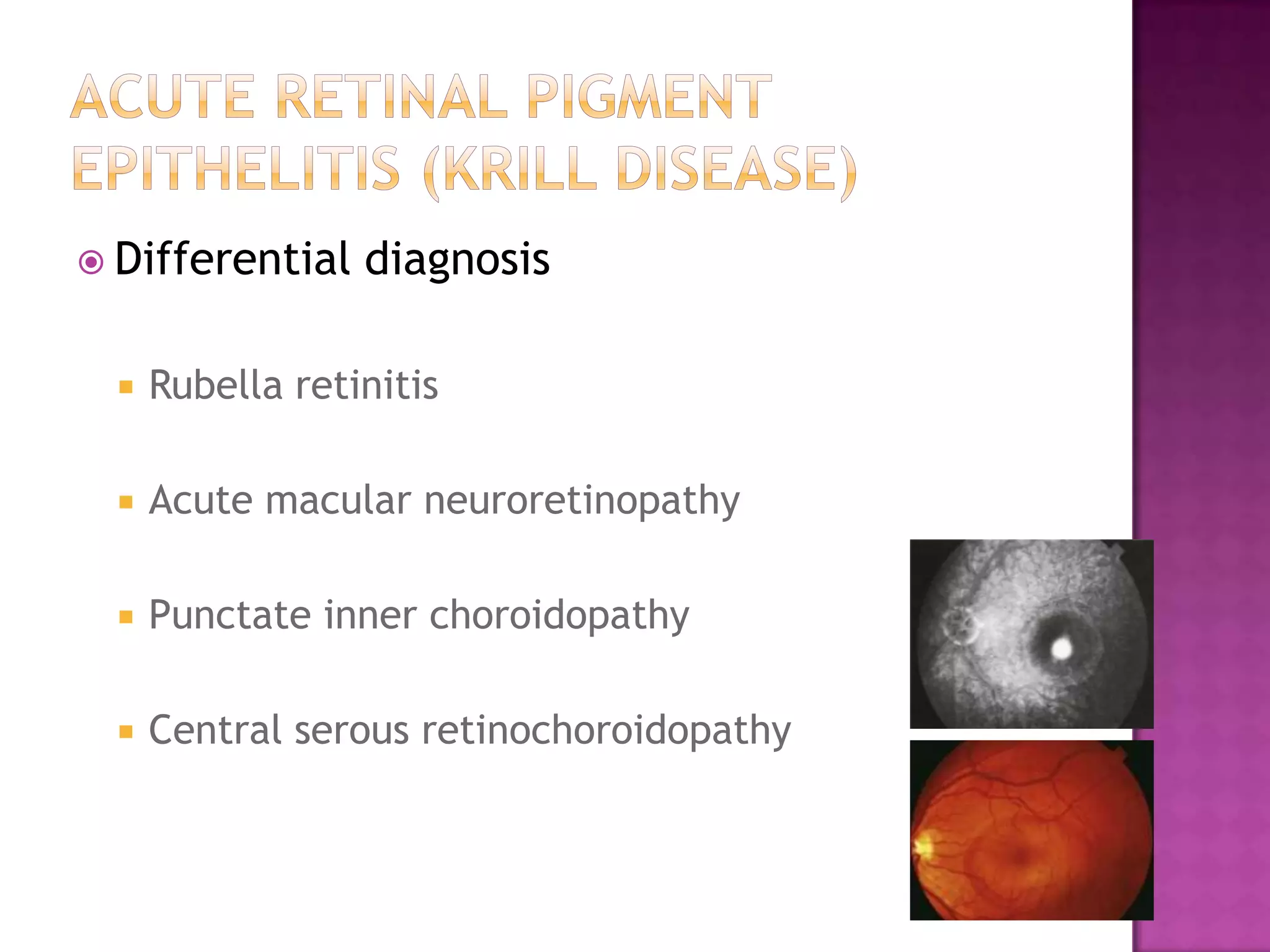 Miscellaneous anterior and posterior uveitis | PPTX