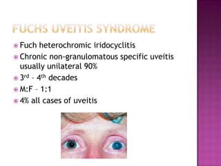 Miscellaneous anterior and posterior uveitis | PPTX