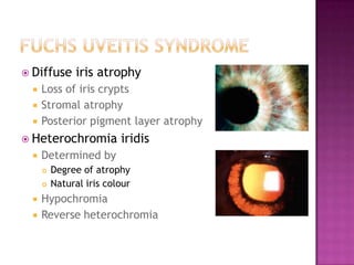 Miscellaneous anterior and posterior uveitis | PPTX