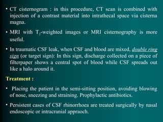 Miscellaneous disorders of nasal cavity | PPT