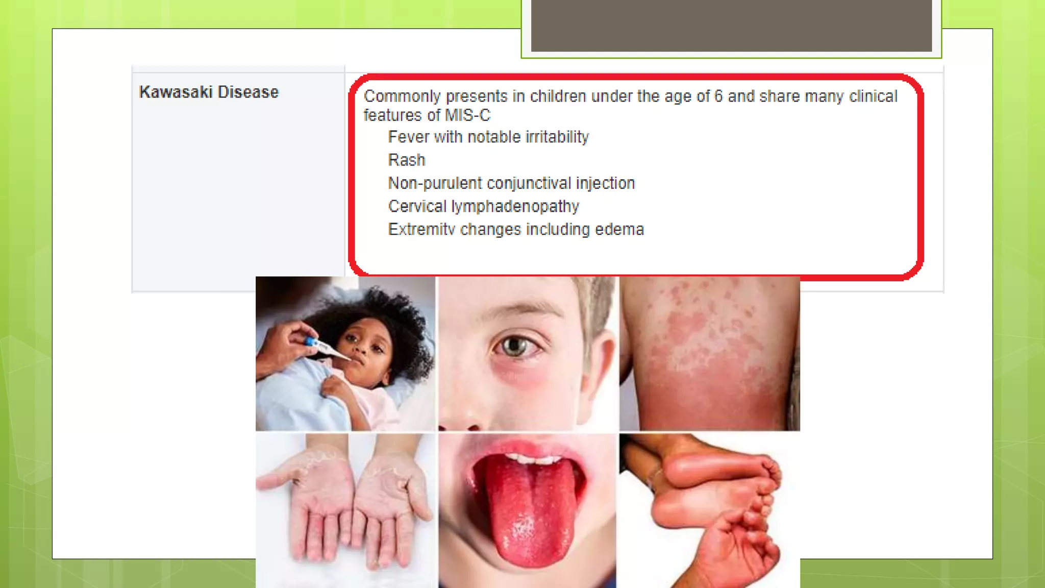 Pediatric MISC | PPT