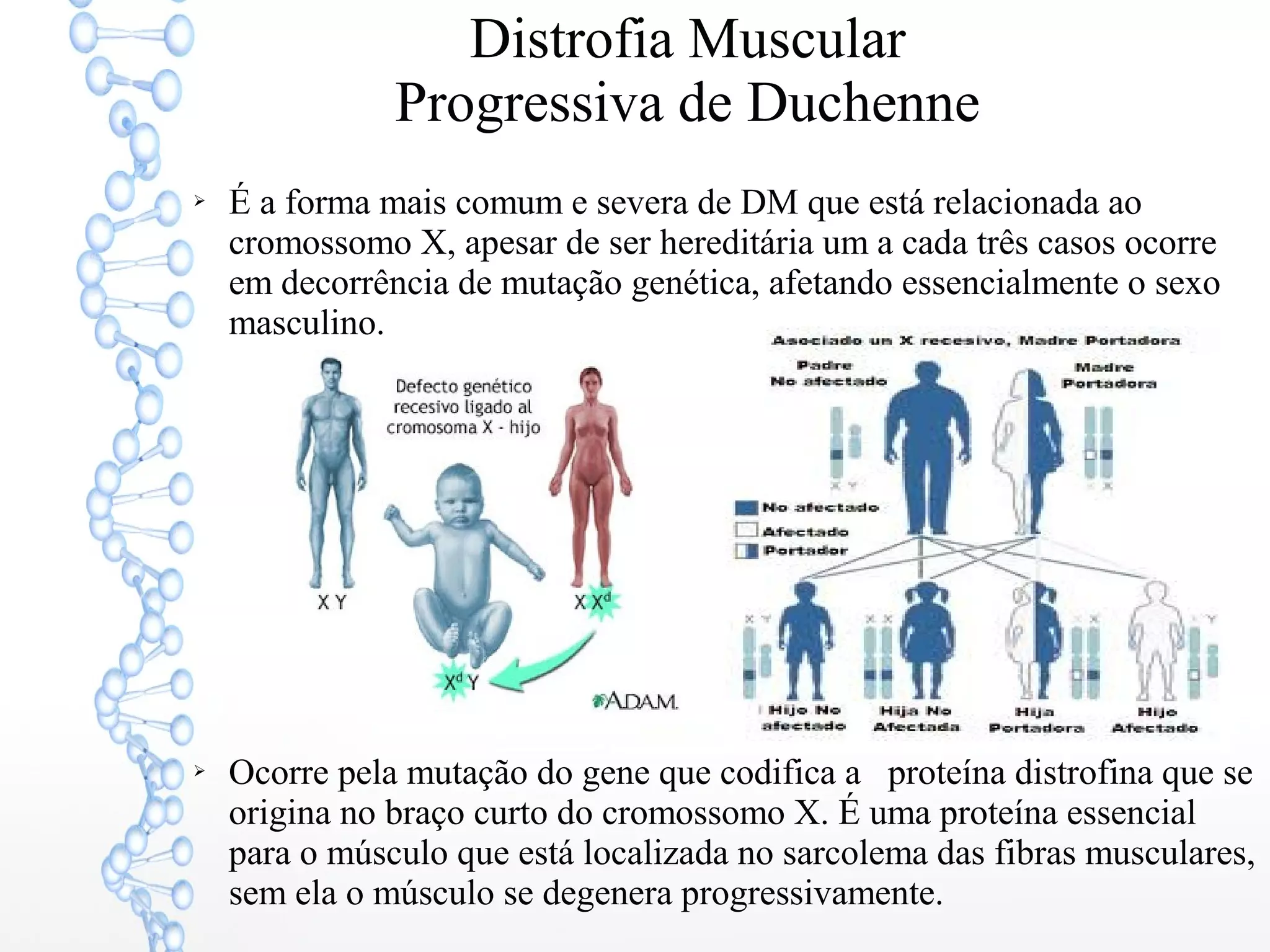 Distrofia Muscular Progressiva de Duchenne | ODP