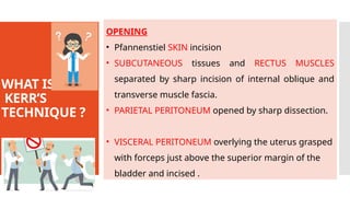 MISGAV LADACH Technique of LSCS | PPTX