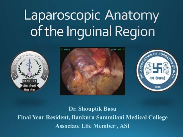 Laparoscopic Anatomy of the Inguinal Region | PPTX | Death, Injury, or ...