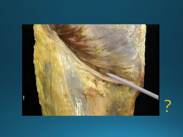 Laparoscopic Anatomy of the Inguinal Region | PPTX | Death, Injury, or ...
