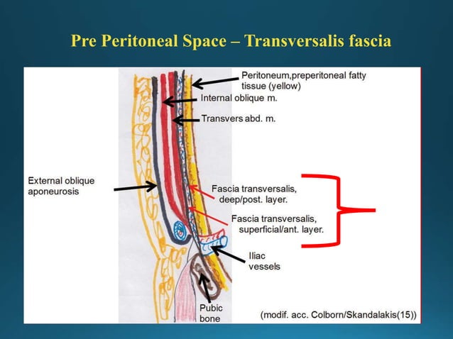 Laparoscopic Anatomy of the Inguinal Region | PPTX | Death, Injury, or ...