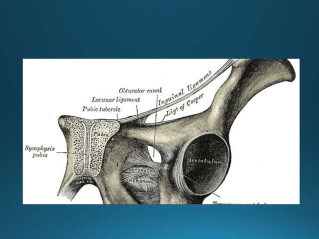 Laparoscopic Anatomy of the Inguinal Region | PPTX | Death, Injury, or ...