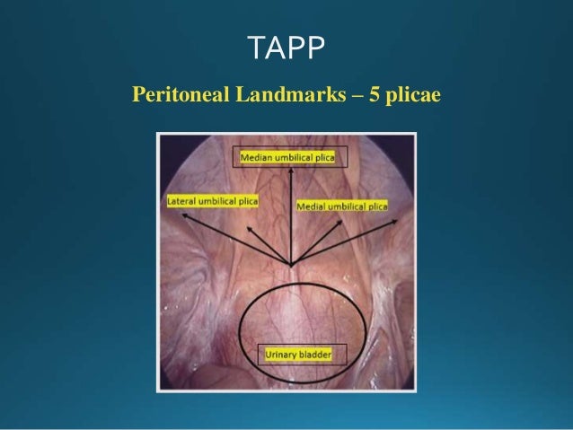Laparoscopic Anatomy of the Inguinal Region