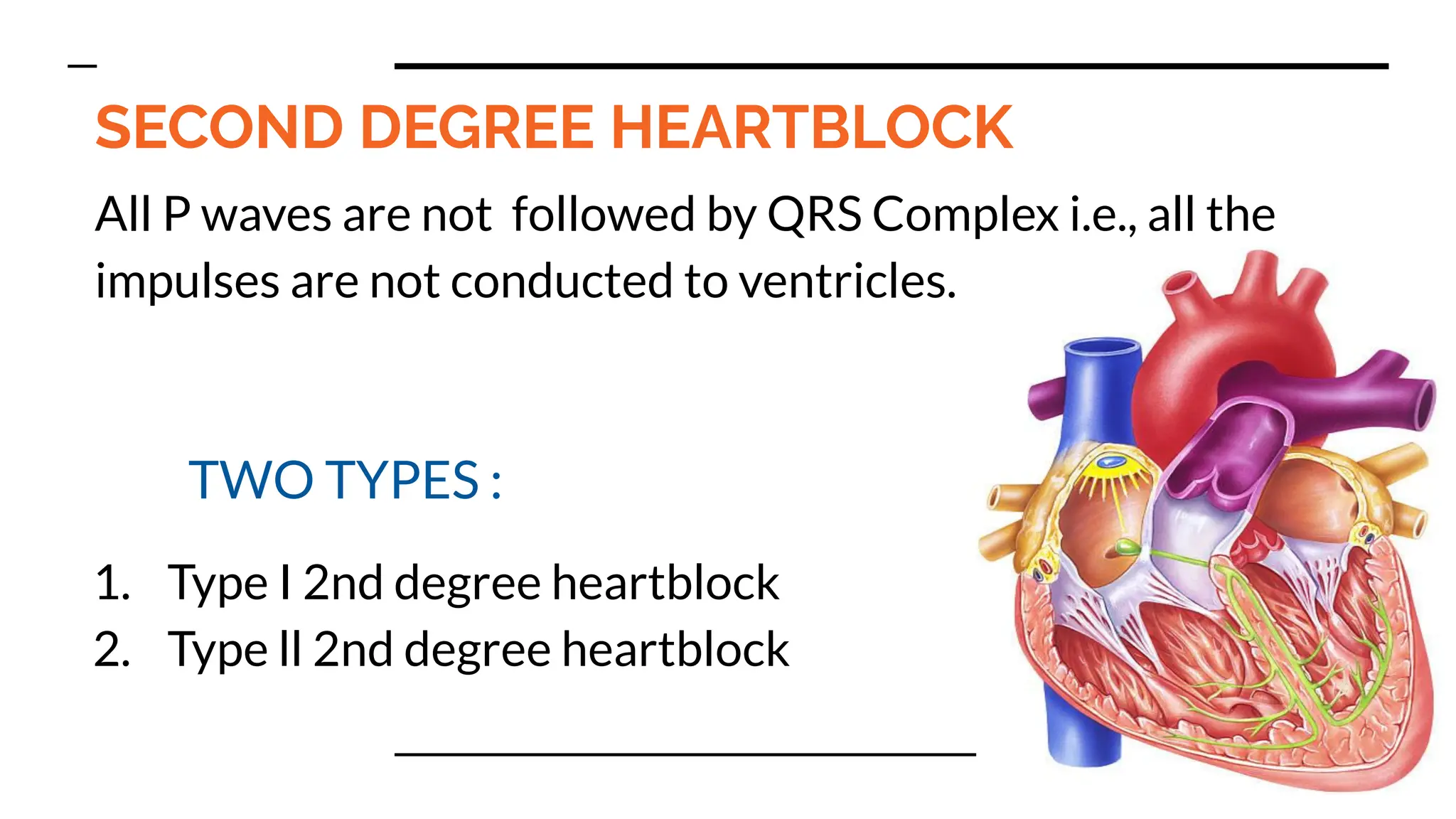 Types of heart blocks with it's ecg variations | PDF