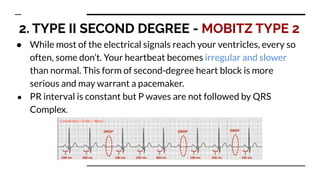 Types of heart blocks with it's ecg variations | PPT