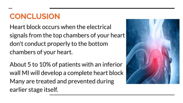 Types of heart blocks with it's ecg variations | PPT