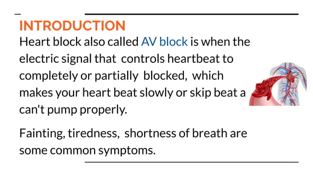 Types of heart blocks with it's ecg variations | PPT