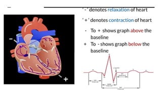 Types of heart blocks with it's ecg variations | PPT